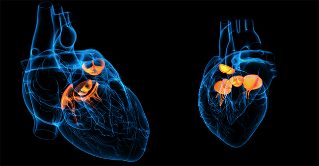 MitraClip for Tricuspid Regurgitation Gains Traction but Still in ...