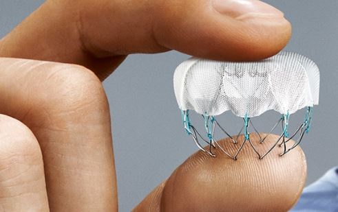 Complications Spiked, Then Fell, After Initial Introduction of Watchman ...