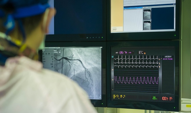 Ionizing Radiation in CV Imaging: New Expert Consensus Document Aims to ...