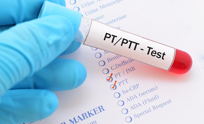 Stay Away From Warfarin-Based Triple Therapy in Patients With A-fib and ...