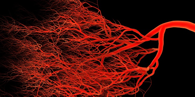 Microvascular Disease Quadruples Risk of Leg Amputation | tctmd.com