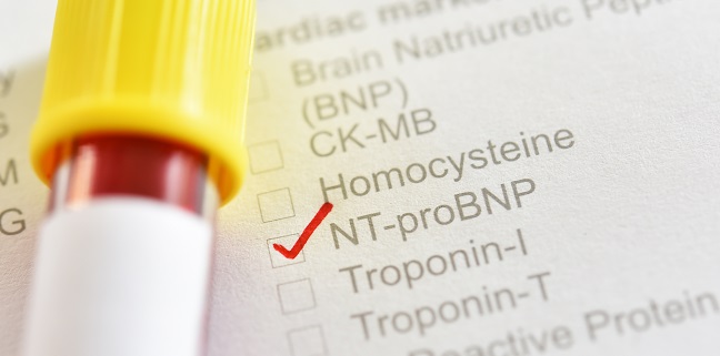 New PROVE-HF Data May Reassure Clinicians of Sacubitril/Valsartan ...