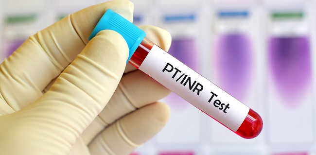 For A-fib/PCI Combo, Edoxaban Matches VKA but Not Superior: ENTRUST-AF ...