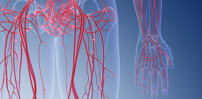 DCBs Show Consistent Long-term Benefits in Complex Fem-Pop Patient ...