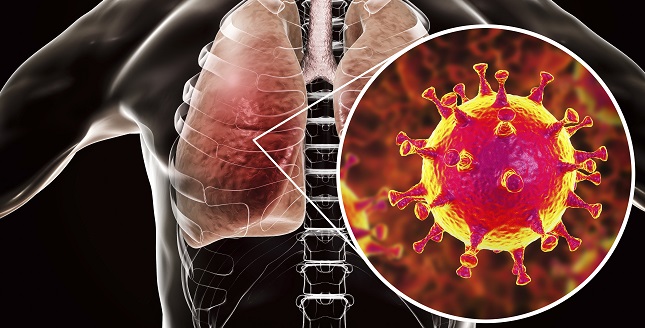 COVID-19 Autopsies Put Endothelial Damage, Angiogenesis in the ...