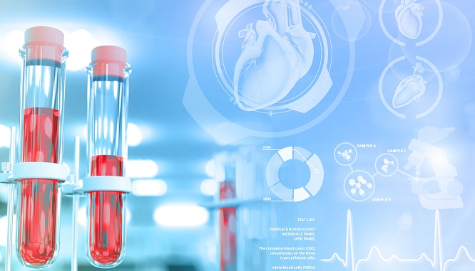 Troponin Testing in COVID-19: New Review Offers a Framework for Use ...