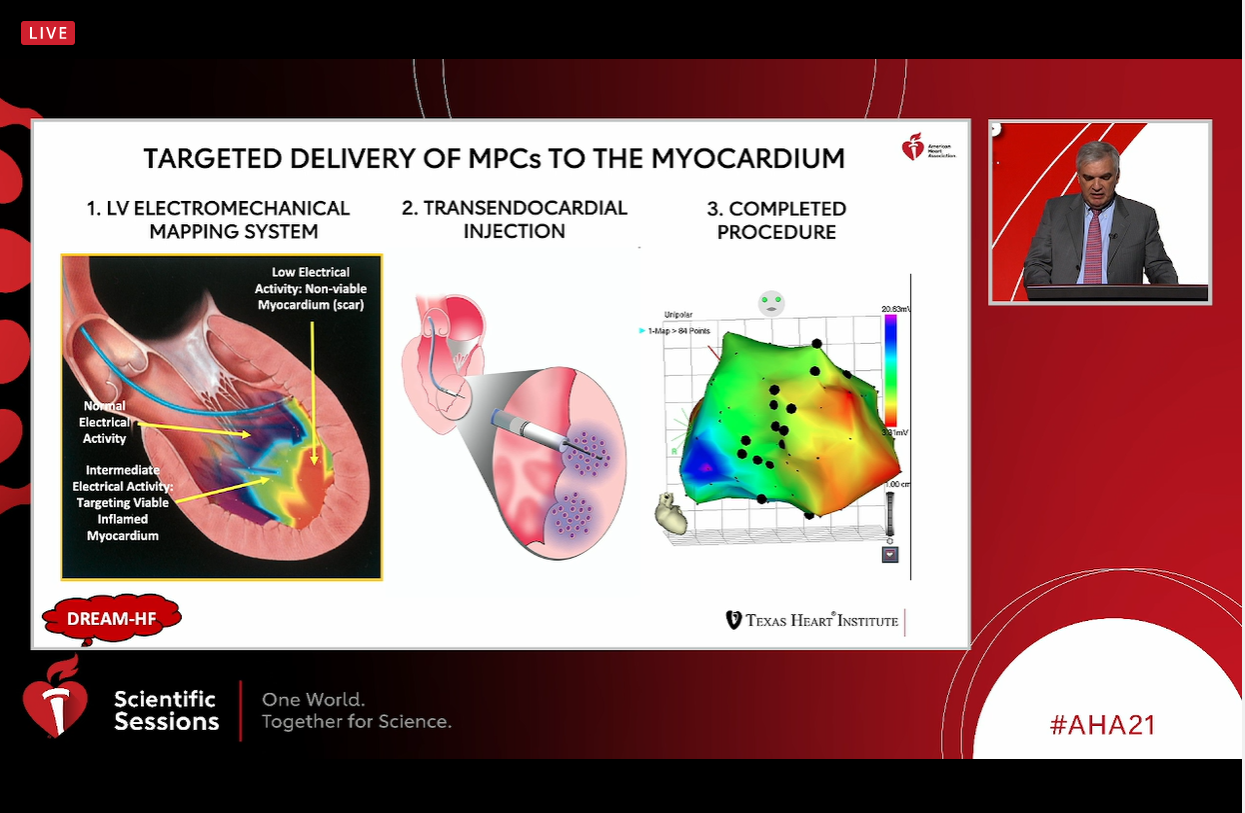 Trial of Cell Therapy for HF Misses Primary Endpoint, but Signals a ...