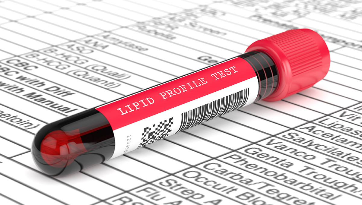 Don’t Just Prescribe a Statin—Measure and Control LDL, Say NLA, ASPC ...