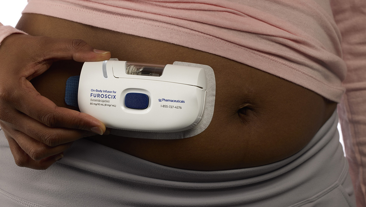 Subcutaneous Furosemide Enables HF Patients to Address Congestion at ...