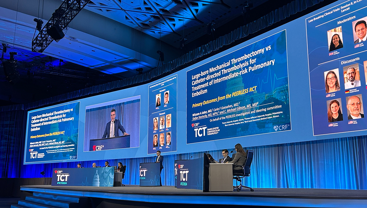 PEERLESS: FlowTriever Tops Catheter-Directed Thrombolysis for Acute PE ...