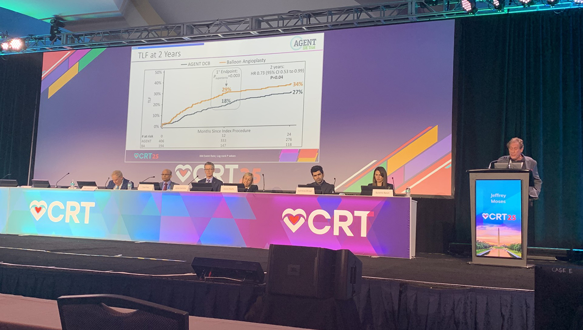 AGENT IDE: DCB Performance for In-Stent Restenosis Lasts Out to 2 Years ...
