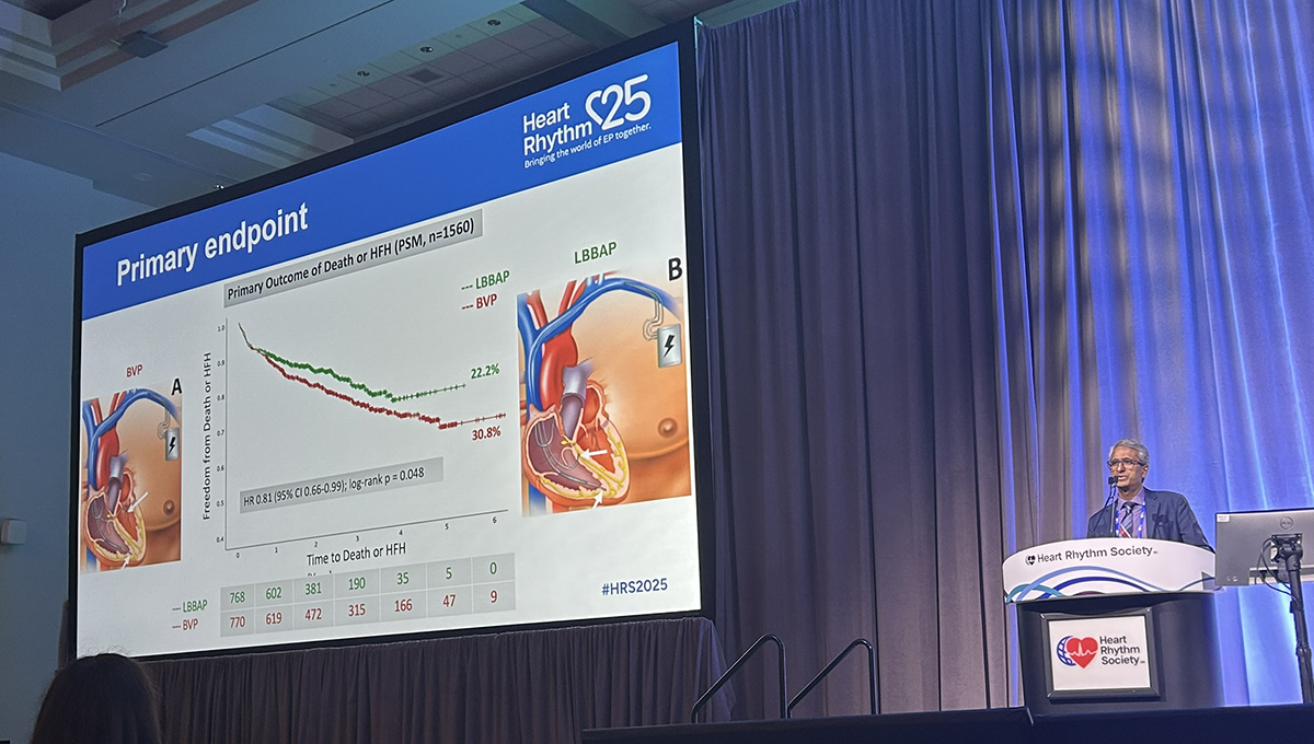 CRT Patients Fare Better With LBB Area vs Biventricular Pacing | tctmd.com