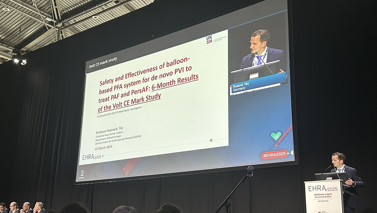 Positive Results With Volt Pulsed-Field Ablation System | tctmd.com