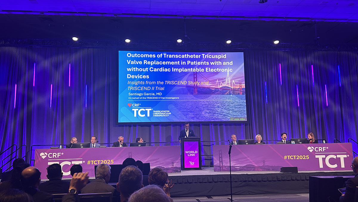 TTVR Remains Safe, Effective in Presence of CIED Leads | tctmd.com