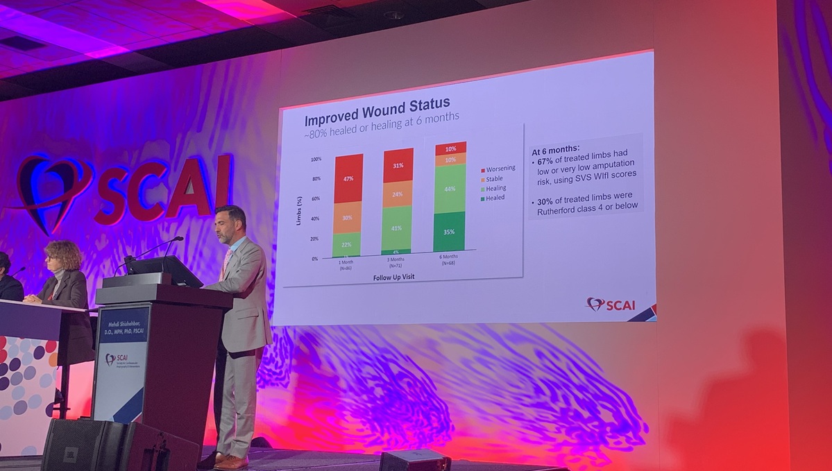 No-Option CLTI Patients Report Better QoL After Blood Flow Diversion ...
