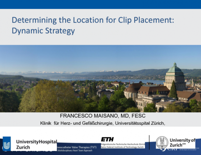 Determining The Location For Clip Placement Dynamic Strategy