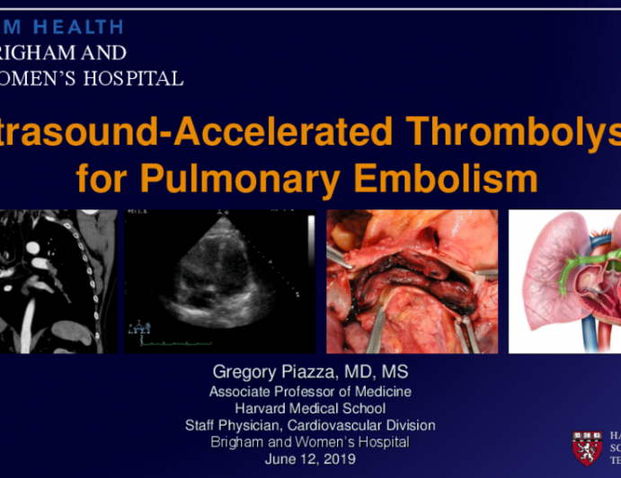 Ultrasound Accelerated Thrombolysis For Pulmonary Embolism