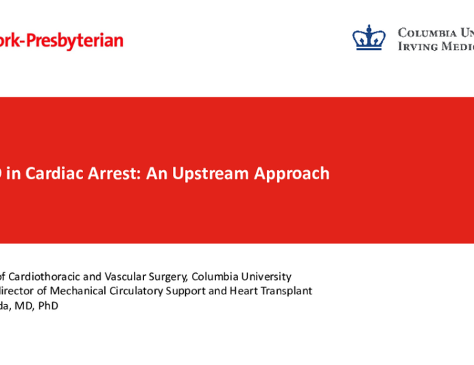 ECMO in Cardiac Arrest: An Upstream Approach | tctmd.com ECMO in Cardiac Arrest: An Upstream Approach | tctmd.com