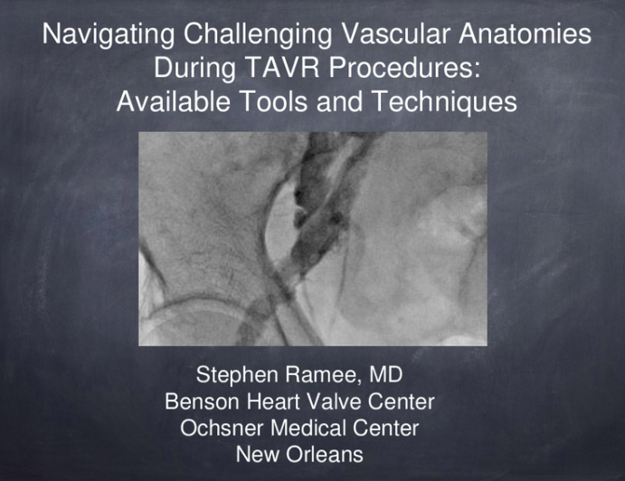 Keynote Lecture Navigating Challenging Vascular Anatomies During Tavr