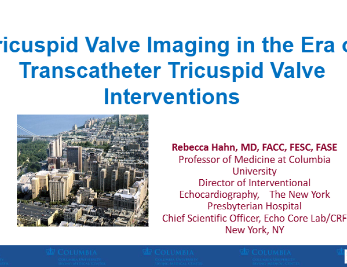 Tricuspid Valve Imaging in the Era of Transcatheter Tricuspid Valve ...